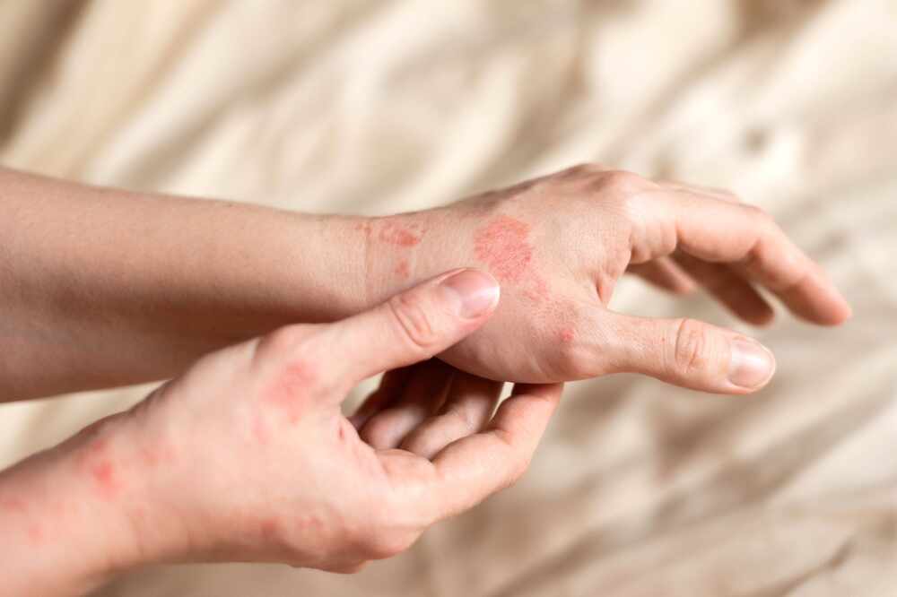 Scientists Reveal Stress-Skin Connection | Health Guide Daily